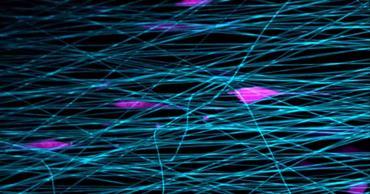 Speedy “slingshot” cell movement observed for the first time ...