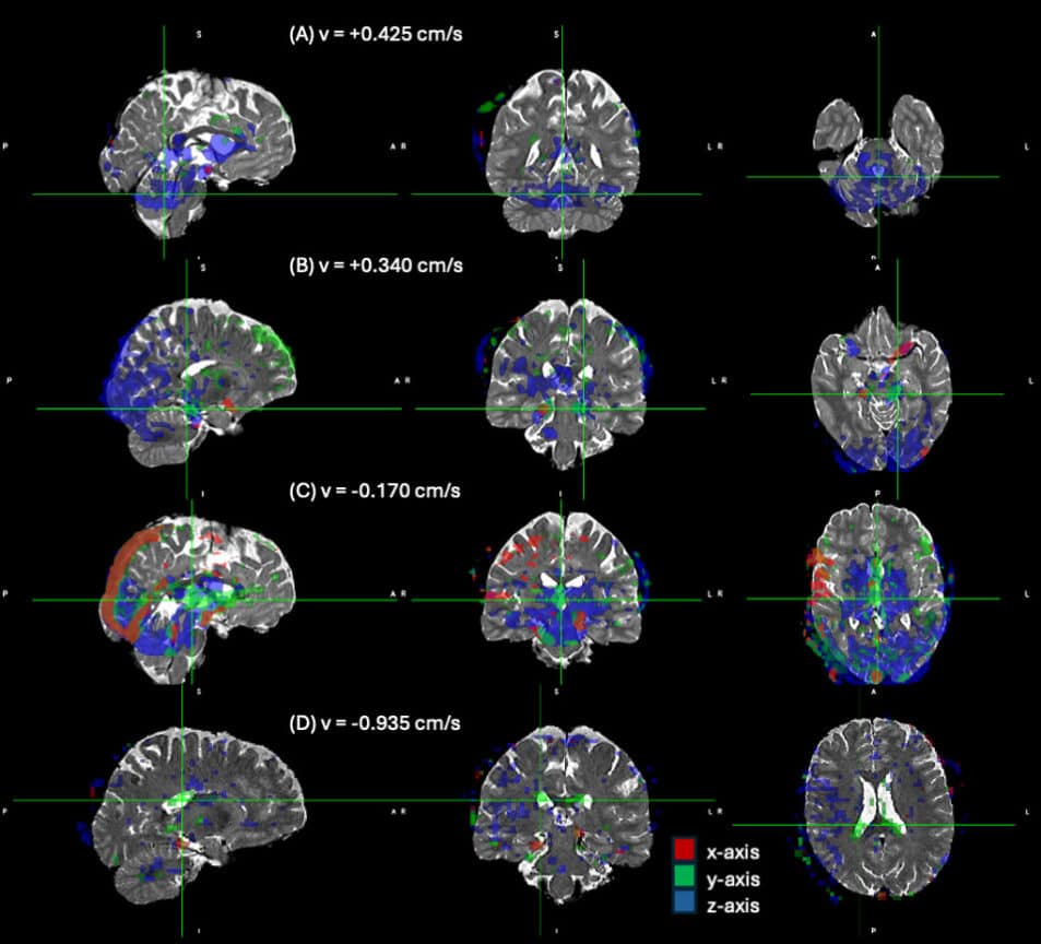 A New Window into Brain Health: U-M’s Researchers Develop Non-Invasive ...