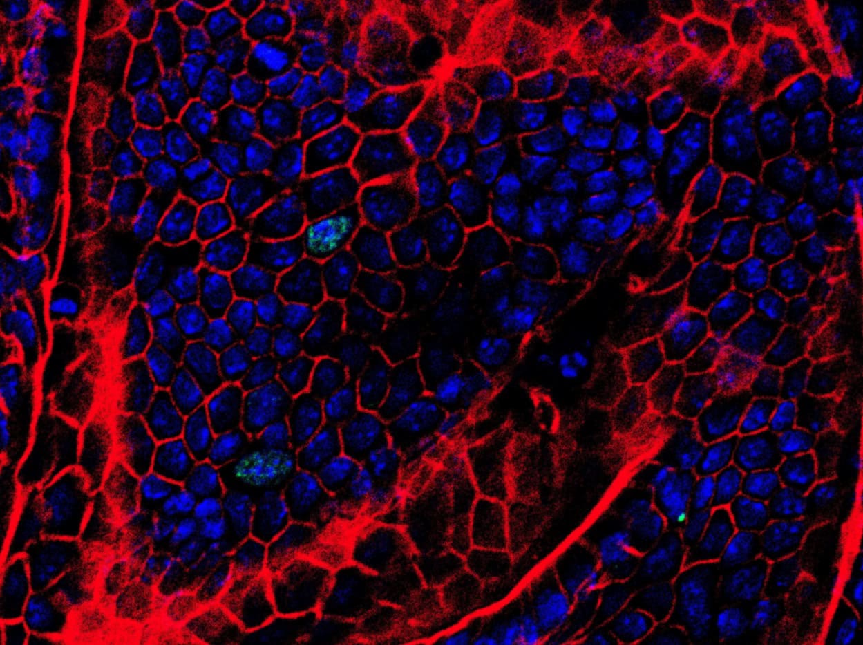 Jiahe Li Lab Examines Breakthrough in Engineering Probiotic Defenses Against Early-Onset Colon ...